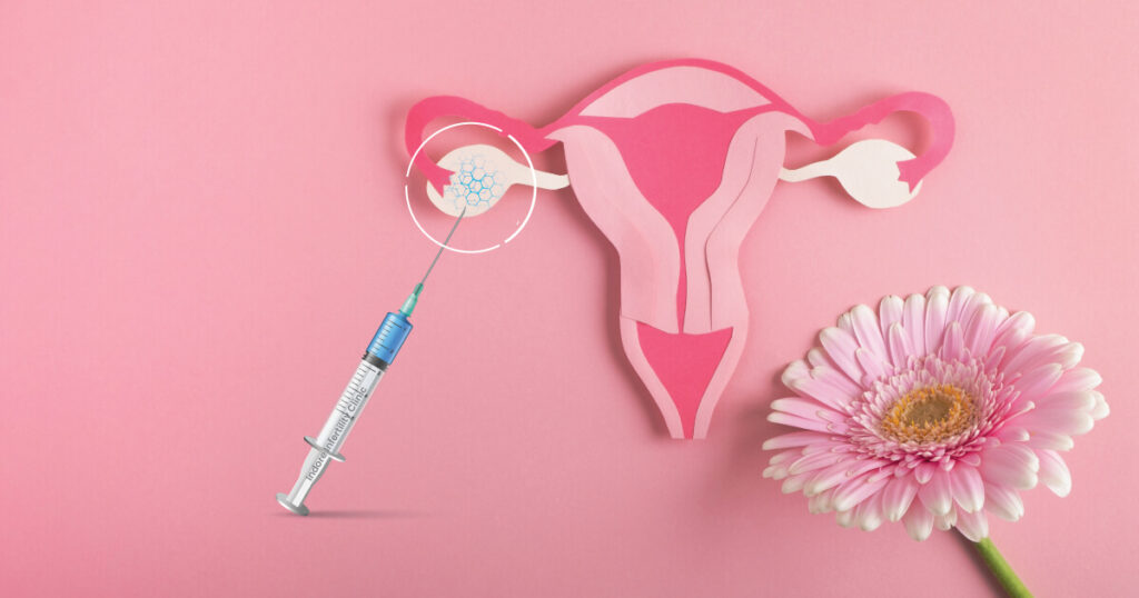 ovarian rejuvenation using PRP stem cells | Get best solution on IVF at ...