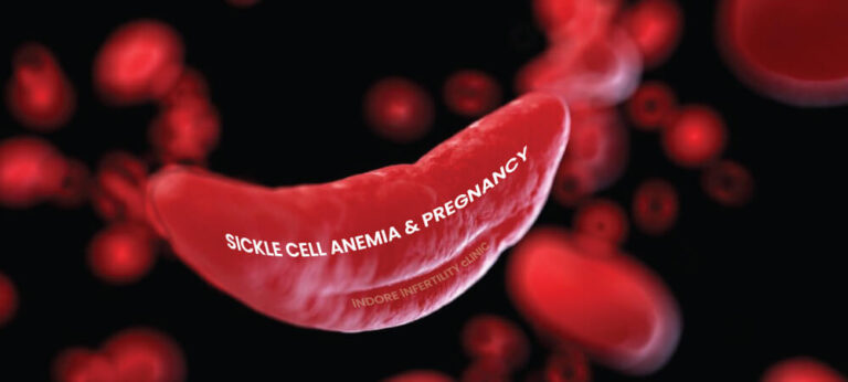 Sickle-Cell Anaemia, Fertility & Pregnancy