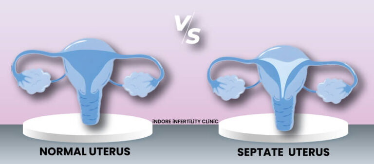 Pregnancy with Uterine Abnormalities - A Comprehensive Guide