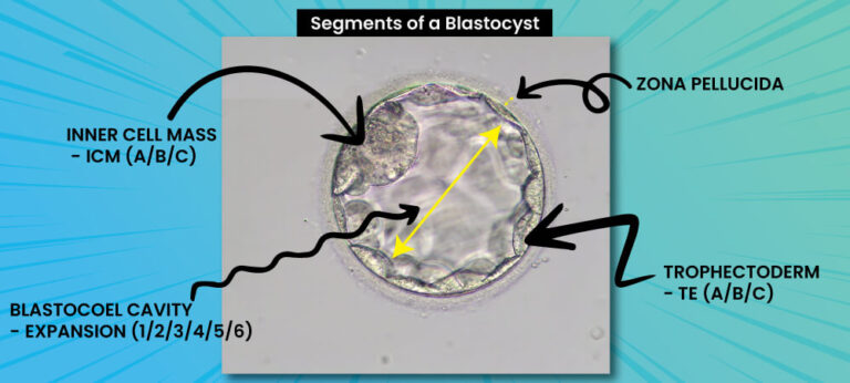 A Patient’s Guide to Embryo Grading - How Good Are My Embryos?