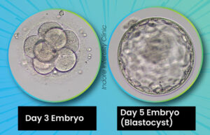 A Patient’s Guide to Embryo Grading - How Good Are My Embryos?