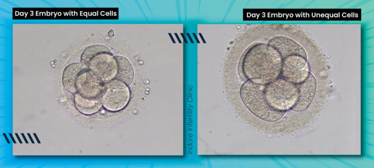 A Patient’s Guide to Embryo Grading - How Good Are My Embryos?
